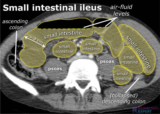 Ct Abdomen General